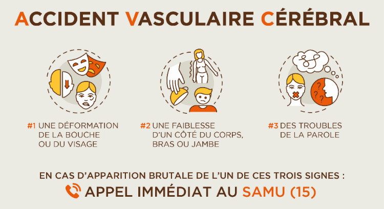 AVC : comprendre pour mieux prévenir | Jevisbien-être.fr